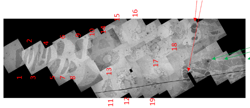 Unobstructed Multi-scale Imaging – Electron Microscopy Core
