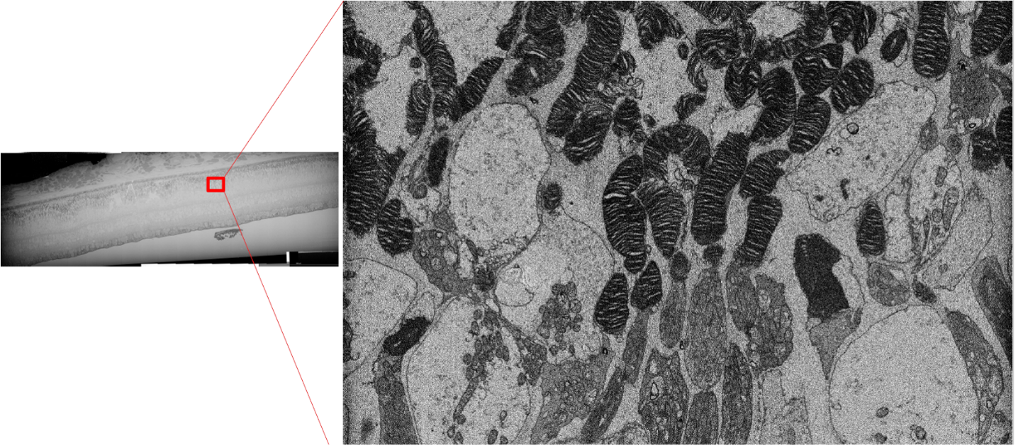 Unobstructed Multi-scale Imaging – Electron Microscopy Core